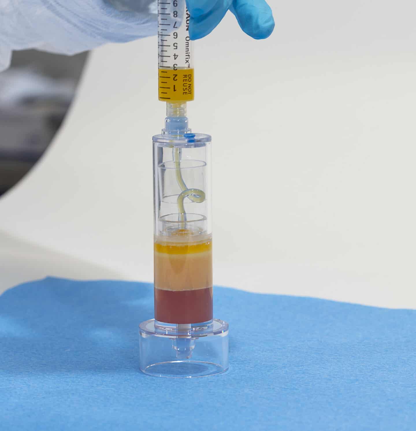 Adipose Concentrating System - Regenerative Medicine Products